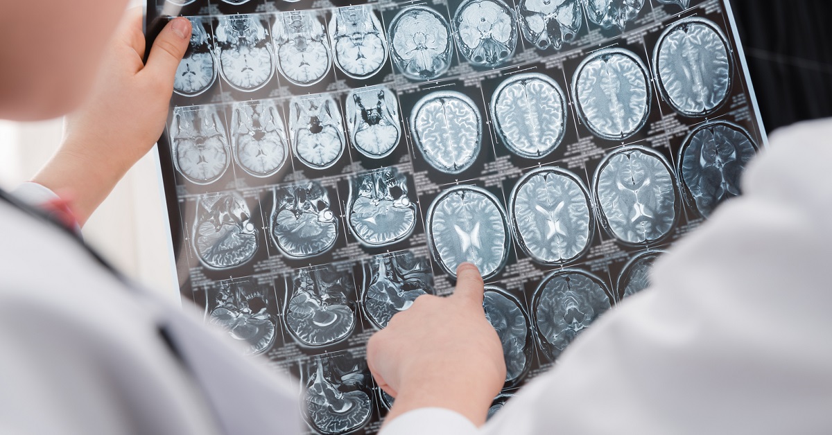 Brain Health Breakthroughs | High-Tech Headband Provides an Early ...